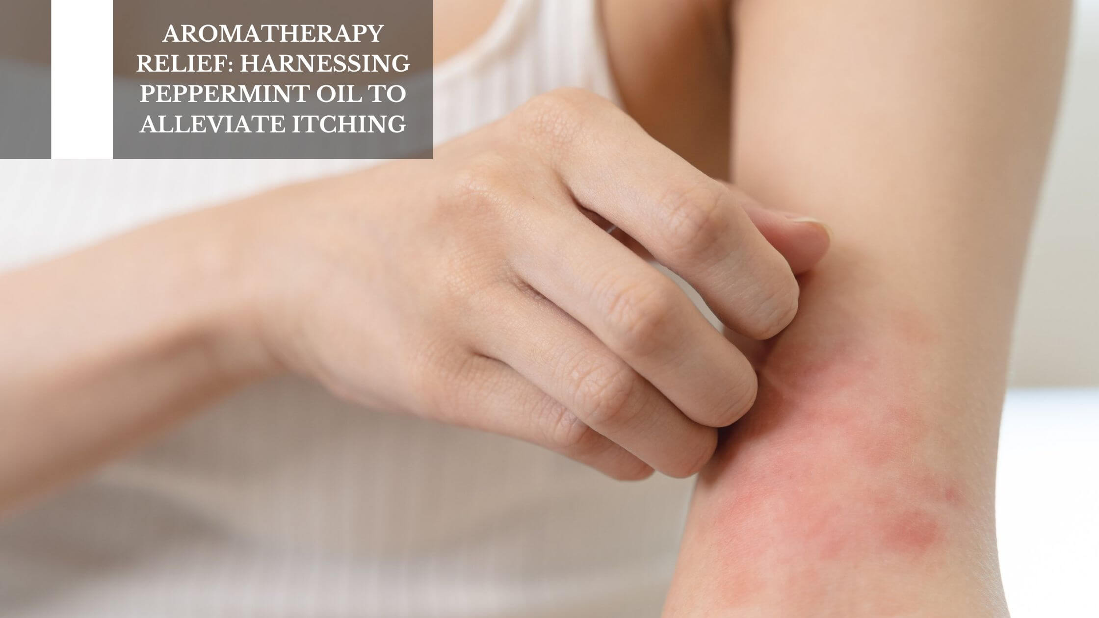 Aromatherapy Relief: Harnessing Peppermint Oil To Alleviate Itching ...