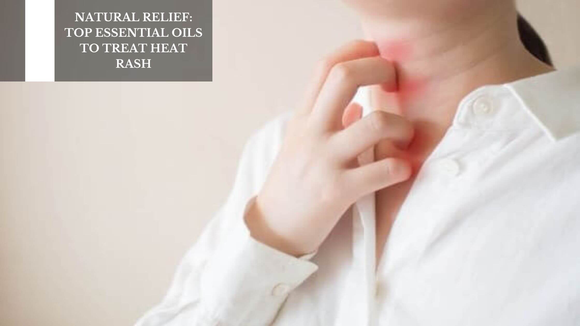 Natural Relief: Top Essential Oils To Treat Heat Rash – Moksha ...